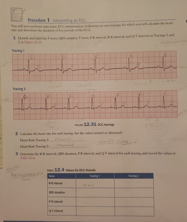 Solved lab exercise Procedure 1 Interpreting and ECG and | Chegg.com