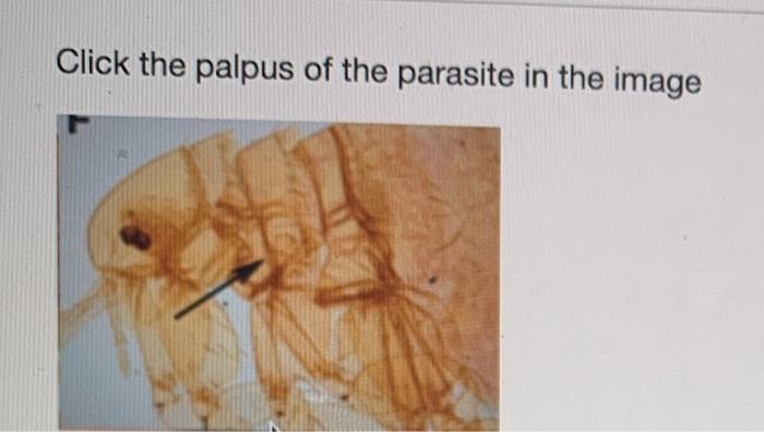 Solved What is the phylum of the parasite seen here? S | Chegg.com