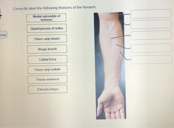 Solved Correctly label the following features of the | Chegg.com