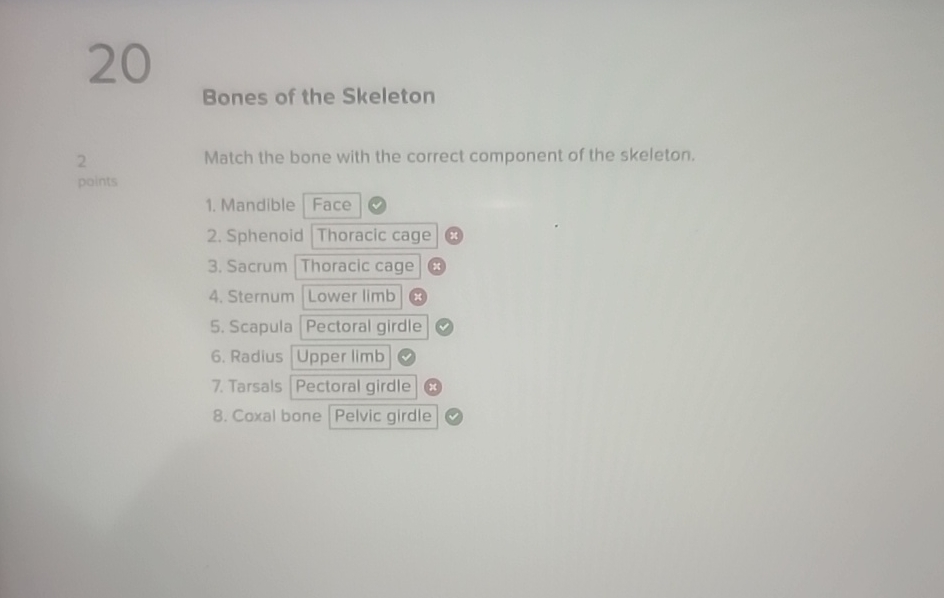 Solved 20Bones of the Skeleton2 ﻿pointsMatch the bone with | Chegg.com