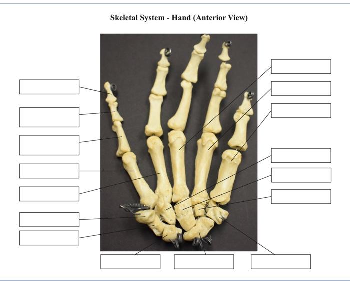 Solved Skeletal System - Hand (Anterior View) | Chegg.com