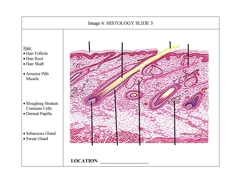 Solved Image 6: HISTOLOGY SLIDE 3Hair:Hair FollicleHair | Chegg.com