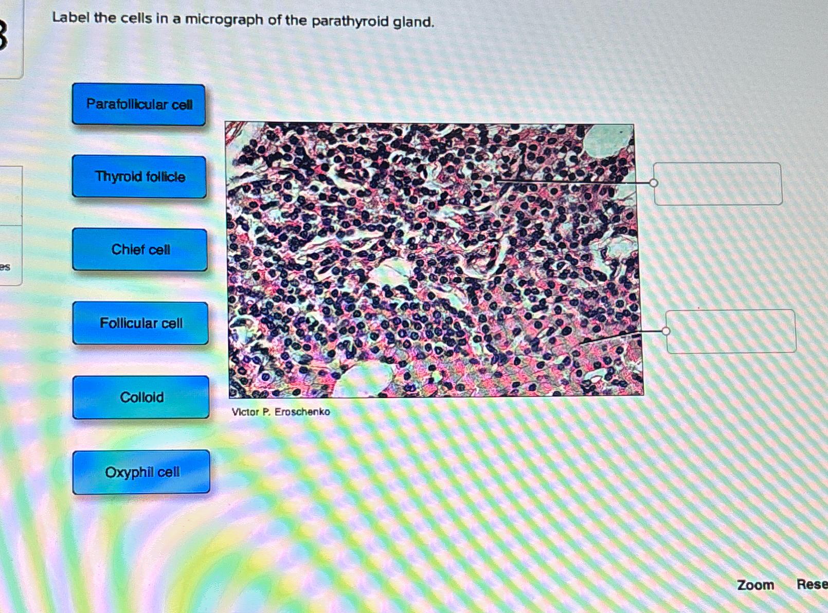 Solved Label the cells in a micrograph of the parathyroid | Chegg.com