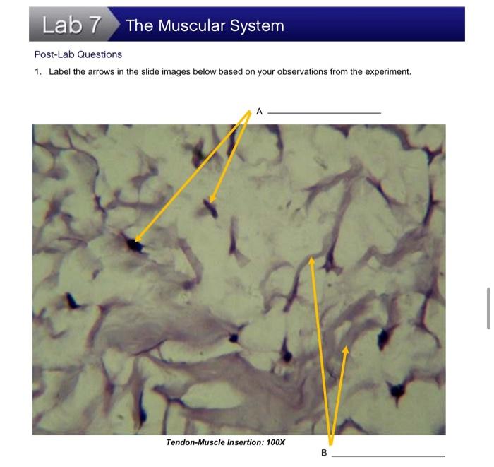 Solved Lab 7 The Muscular System E Tendon (Longitudinal | Chegg.com