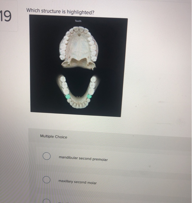 Solved Which structure is highlighted? 27 Multiple Choice | Chegg.com