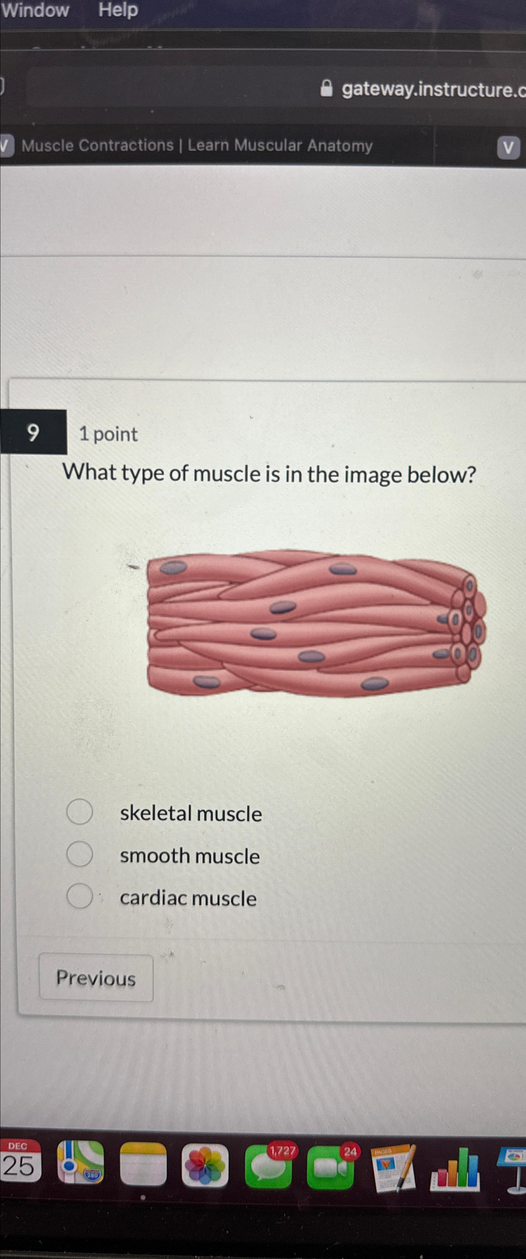 Solved Muscle Contractions | ﻿Learn Muscular Anatomy91 | Chegg.com