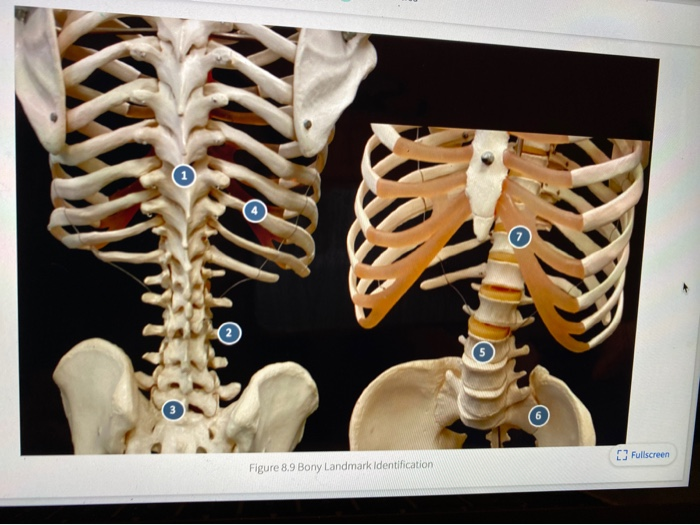 Solved Figure 8.9 Bony Landmark Identification Fullscreen | Chegg.com