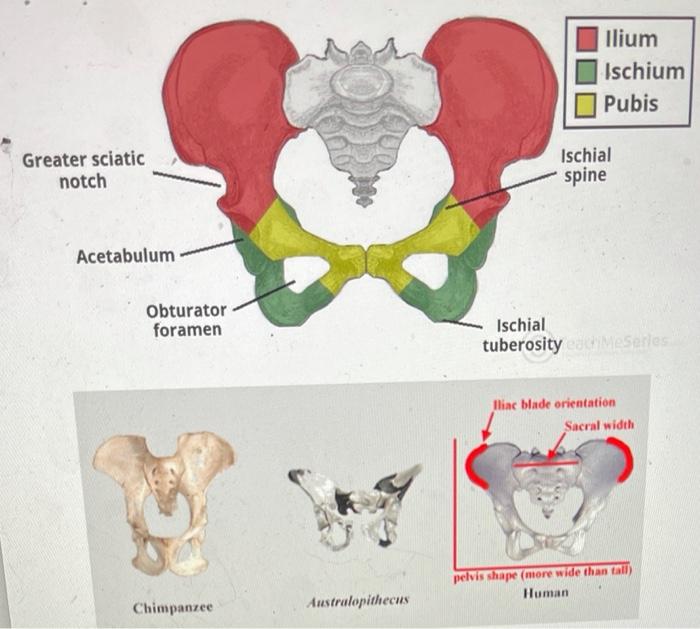 Solved llium Ischium Pubis Greater sciatic notch Ischial | Chegg.com