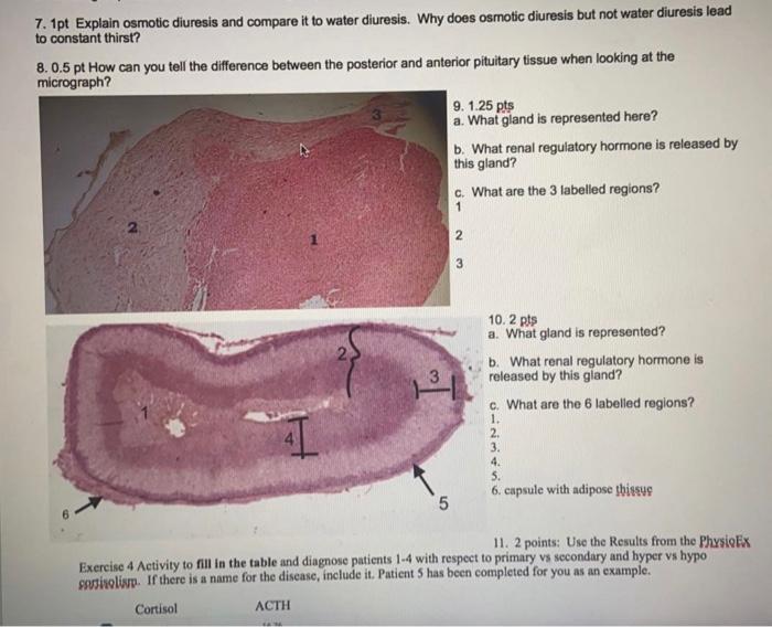 Solved 7 1pt Explain Osmotic Diuresis And Compare It To