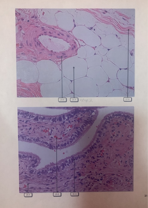 Solved Identify the tissues shown in the following slides | Chegg.com