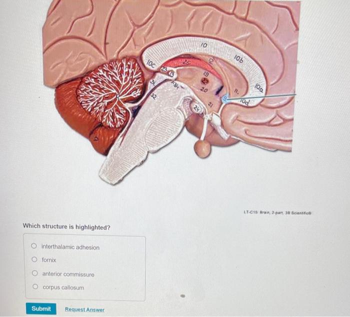 Solved HiCis Arain, Zopart 38 ftientice Which structure is | Chegg.com