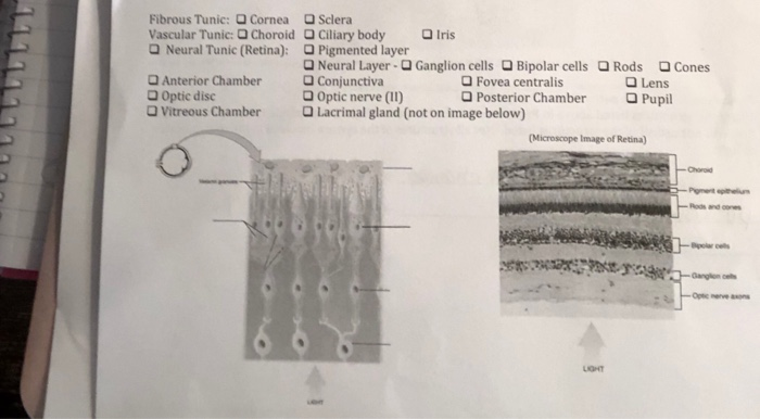 Fibrous Tunic: Cornea Sclera Vascular Tunic: Choroid | Chegg.com