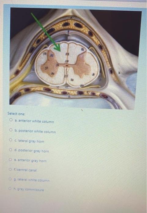 Solved Select one O a anterior white column Ob posterior | Chegg.com