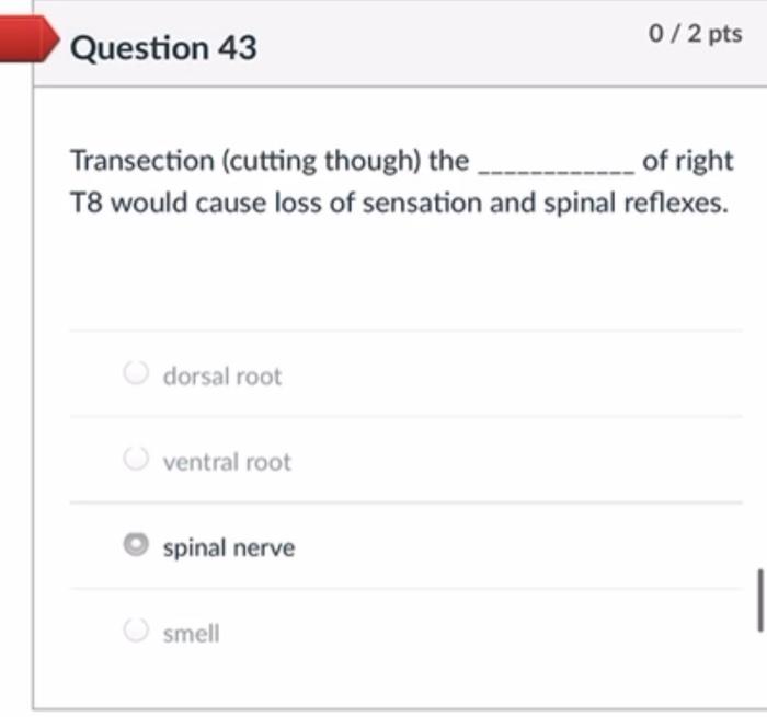 Solved 0/2 pts Question 43 Transection (cutting though) the | Chegg.com