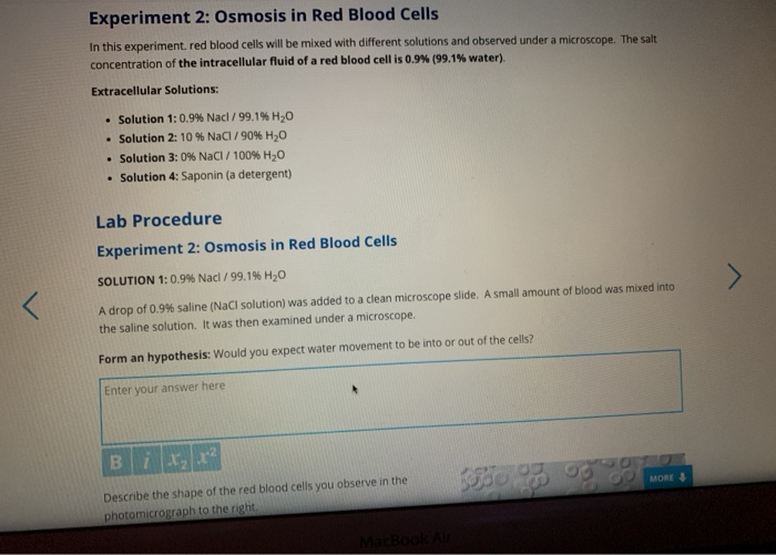 Solved Experiment 2: Osmosis in Red Blood Cells In this | Chegg.com