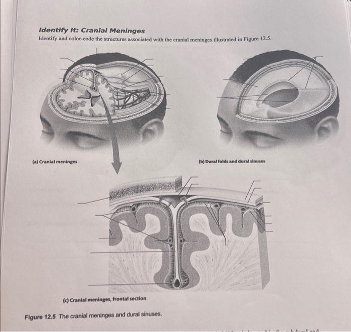 Solved Identify It: Cranial Meninges Identify and color-code | Chegg.com