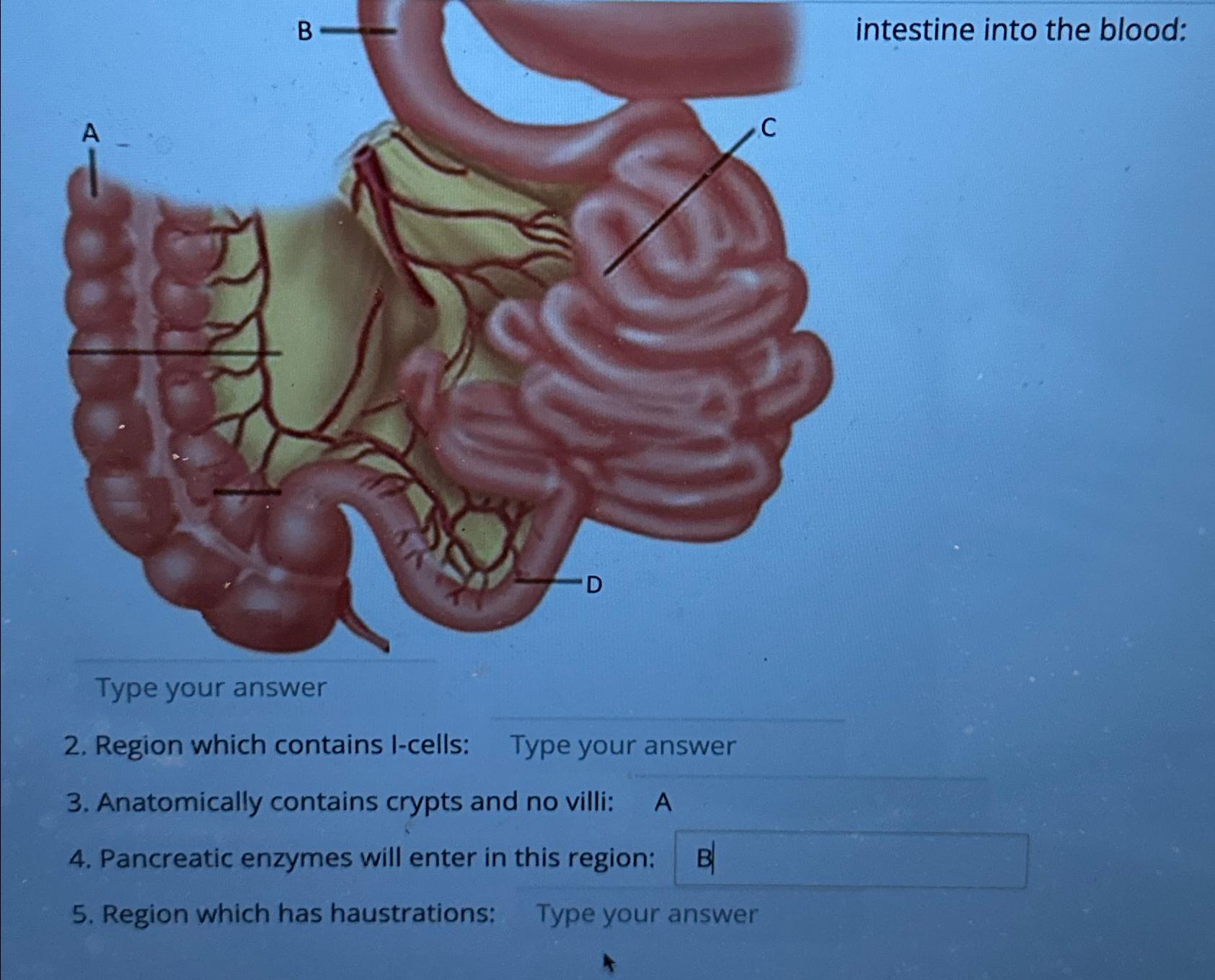 Solved Type your answer2. Region which contains | Chegg.com Solved Type your answer2. Region which contains | Chegg.com