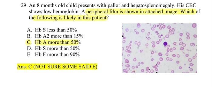 Solved 9. An 8 months old child presents with pallor and | Chegg.com