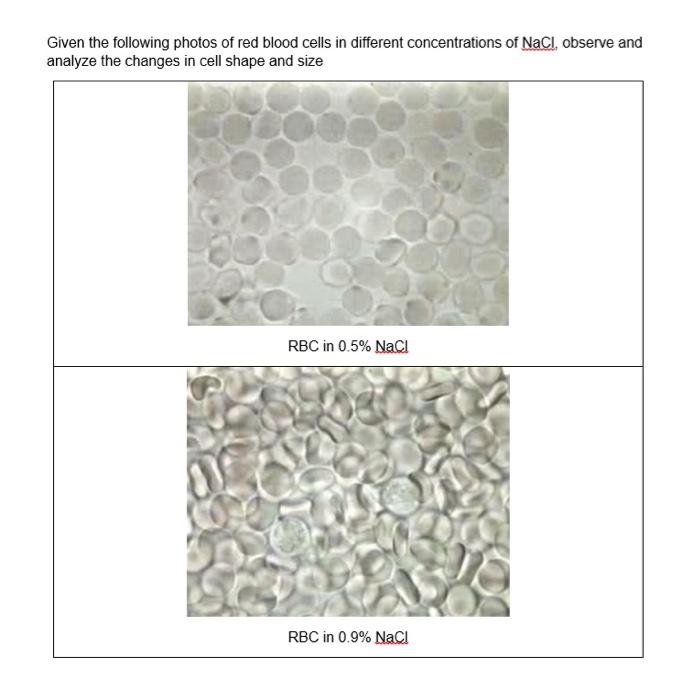 Grethe following photos of red blood as in different | Chegg.com