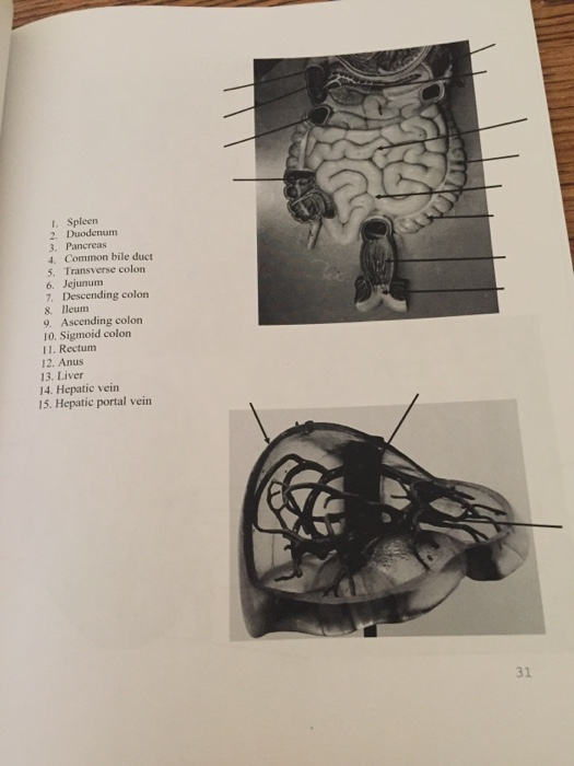 Solved 1. Spleen 2 Duodenum 3. Pancreas 4. Common bile duct | Chegg.com