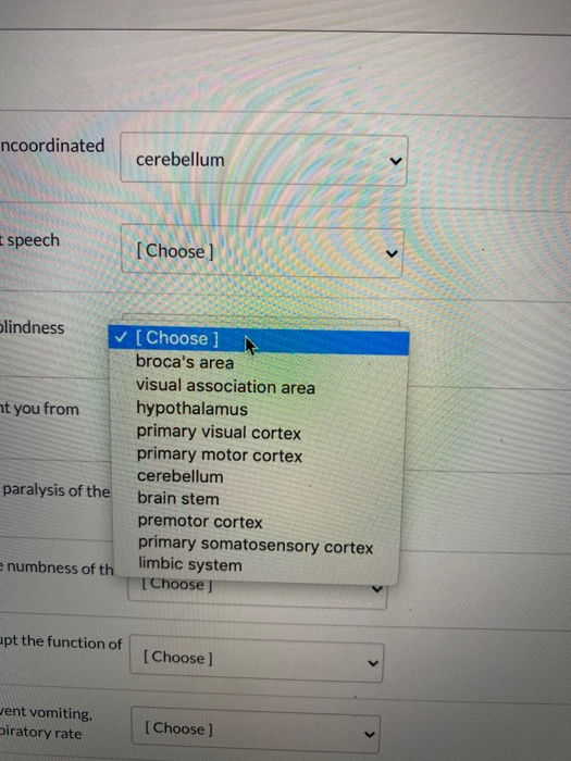 Solved Damage to this would cause uncoordinated movement, | Chegg.com