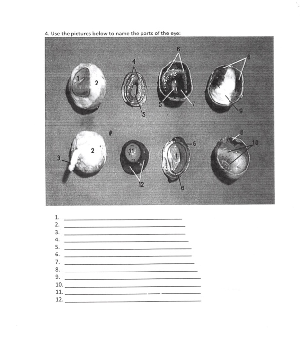 Solved 4. Use the pictures below to name the parts of the | Chegg.com