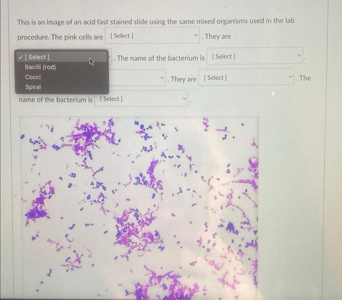 Solved This is an image of an acid fast stained slide using | Chegg.com