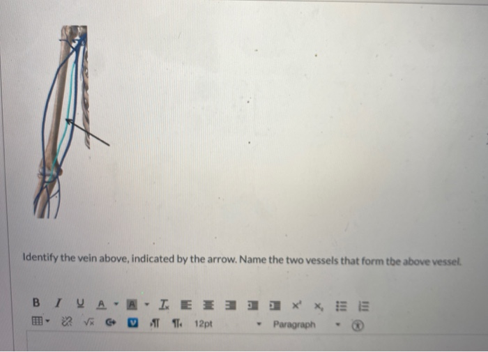 Solved Identify the vein above, indicated by the arrow. Name | Chegg.com