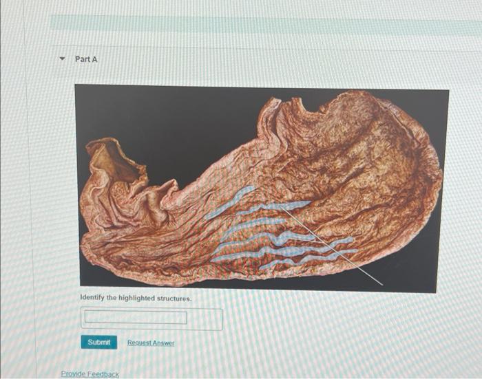 Solved Identify the highlighted structures. | Chegg.com