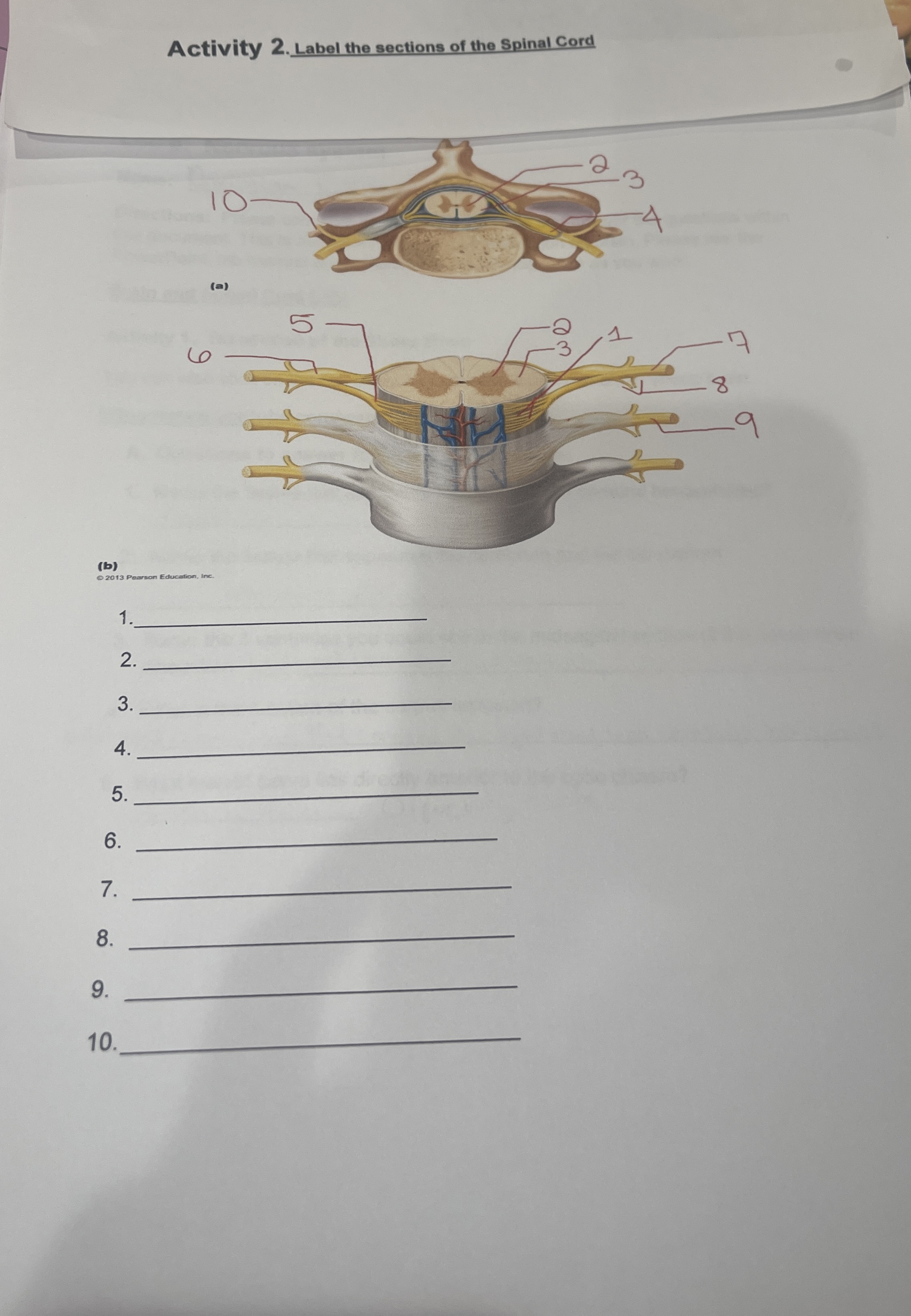 Solved Activity 2. ﻿Label the sections of the Spinal | Chegg.com