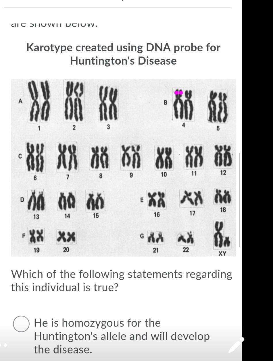 Solved DNA Probe gene of interest fluorescent tag DNA probe | Chegg.com
