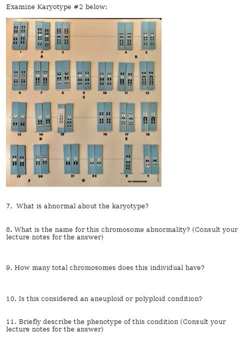 Solved Examine Karyotype #2 below: HE 15 Bk 7. What is | Chegg.com