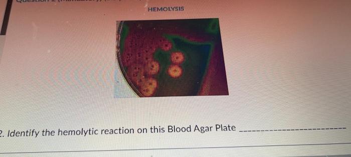 Free ASM MicrobeLibrary.org Buxton 1. What is the | Chegg.com