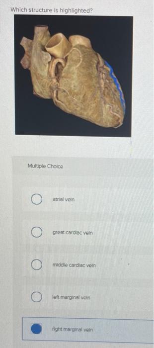 Solved Which structure is highliahted? Multiple Cholce | Chegg.com