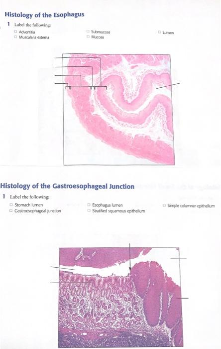 Gastroesophageal Junction Slide Labeled