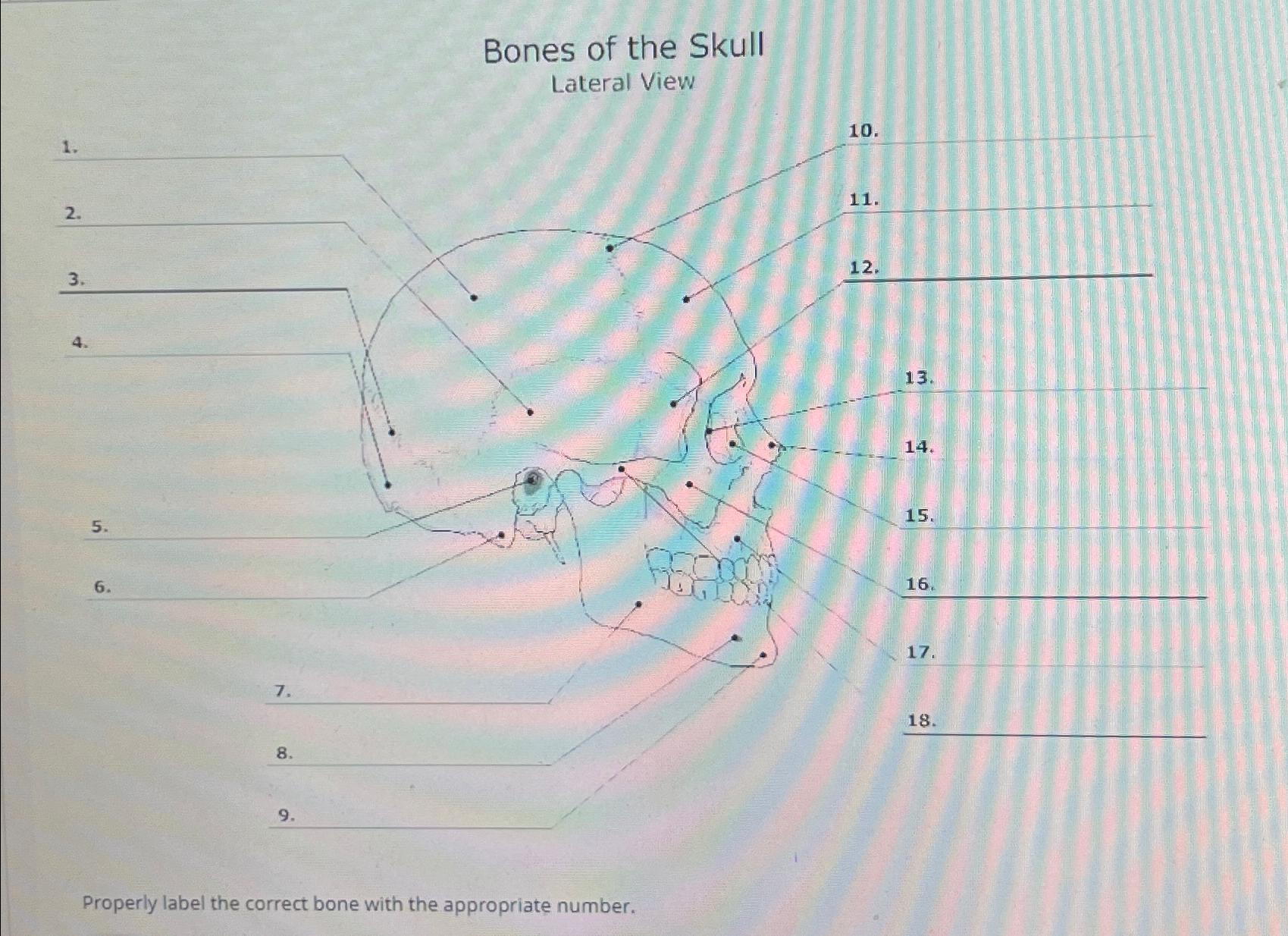 Solved Bones of the Skull Lateral | Chegg.com
