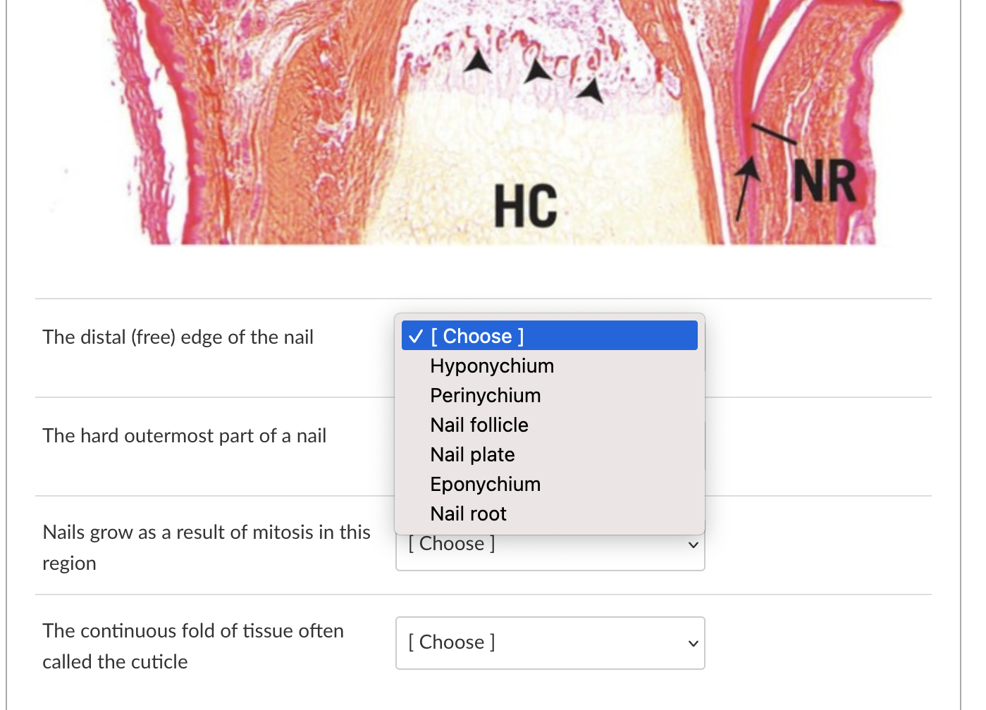Solved The distal (free) ﻿edge of the nailThe hard outermost | Chegg.com