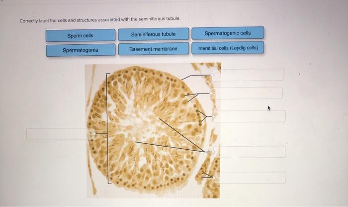 Solved Correctly label the cells and structures associated | Chegg.com