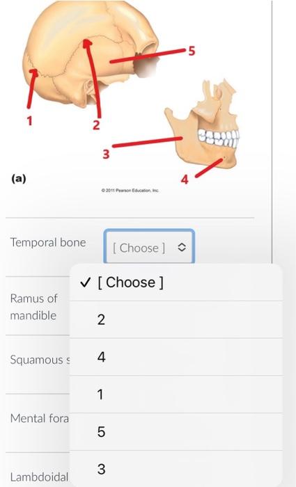 Solved A [Choose] ^ B [Choose] C [Choose] D E [ Choose | Chegg.com