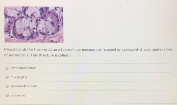 Solved Mixed glands like the one pictured above have mucous | Chegg.com