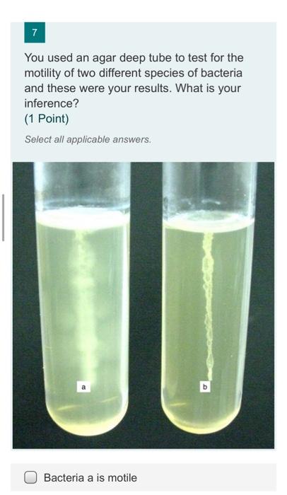 Solved 15 A subculturing experiment was assigned for Aziz in | Chegg.com