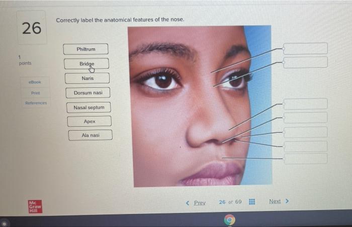 Solved Correctly label the anatomical features of the nose. | Chegg.com