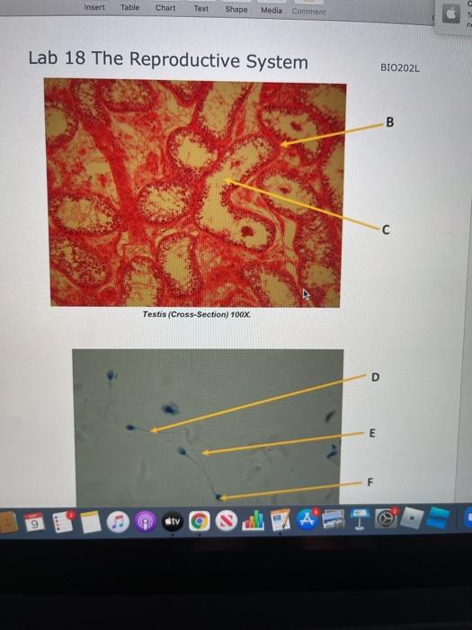 Solved Experiment 1: Microscopic Anatomy of the Reproductive | Chegg.com
