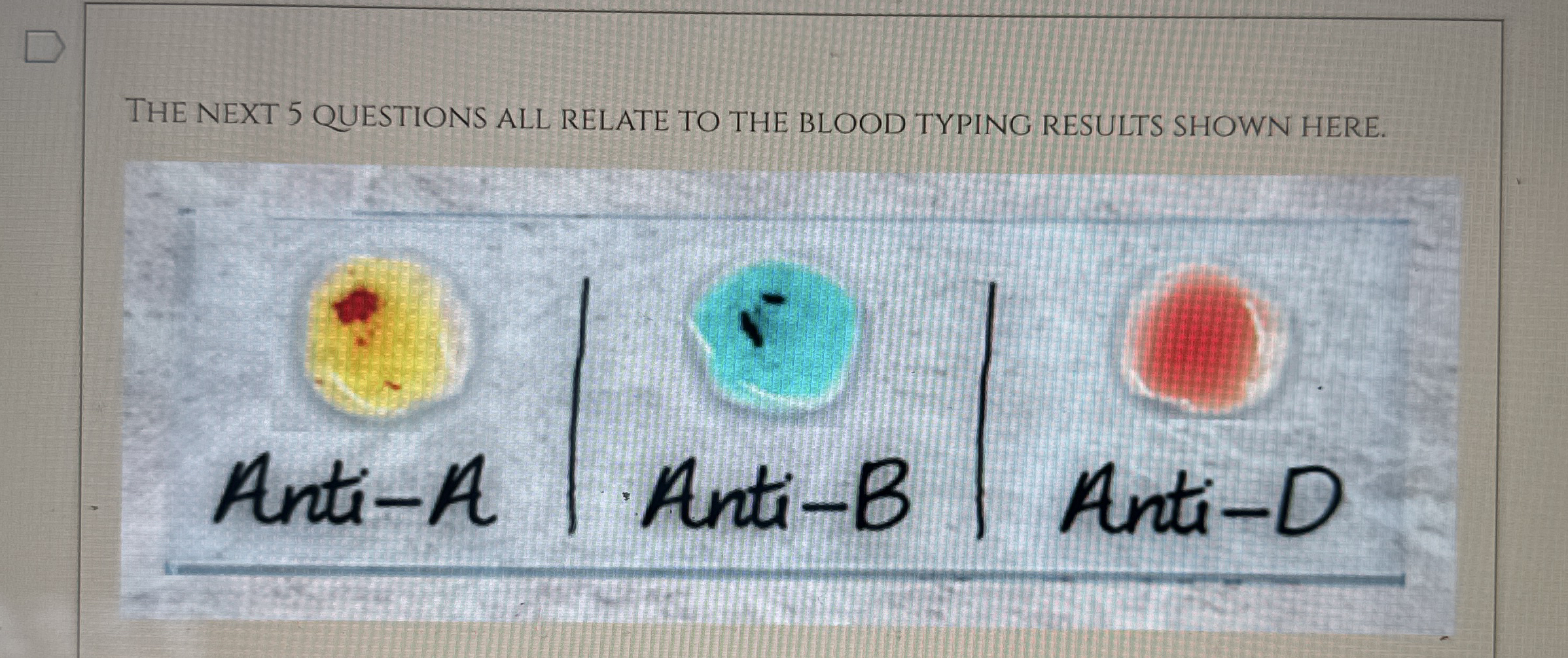 Solved THE NEXT 5 ﻿QUESTIONS ALL RELATE TO THE BLOOD TYPING | Chegg.com