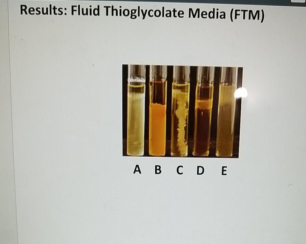 Solved The following biochemical test was performed: FTM The | Chegg.com