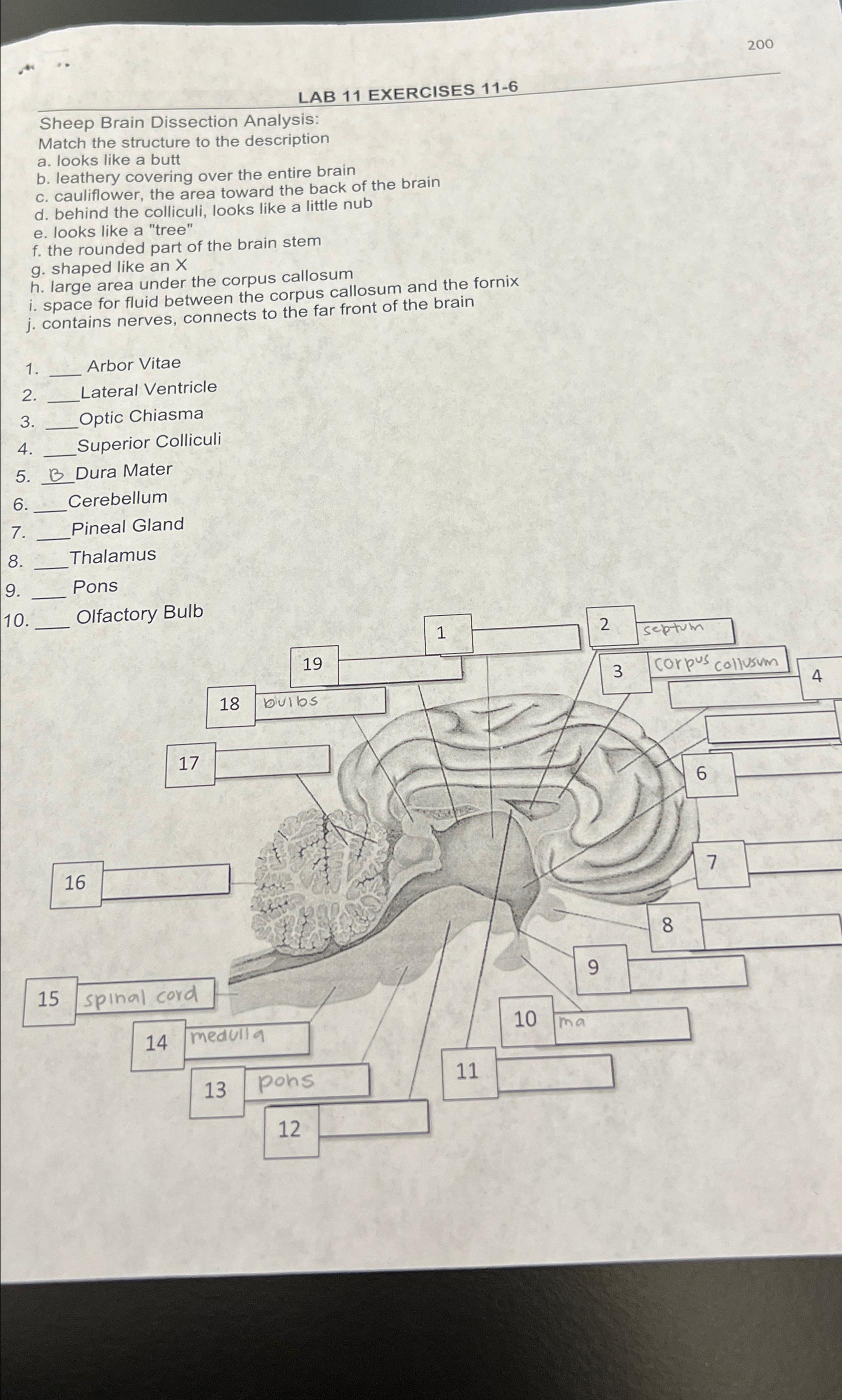 Solved 200LAB 11 ﻿EXERCISES 11-6Sheep Brain Dissection | Chegg.com