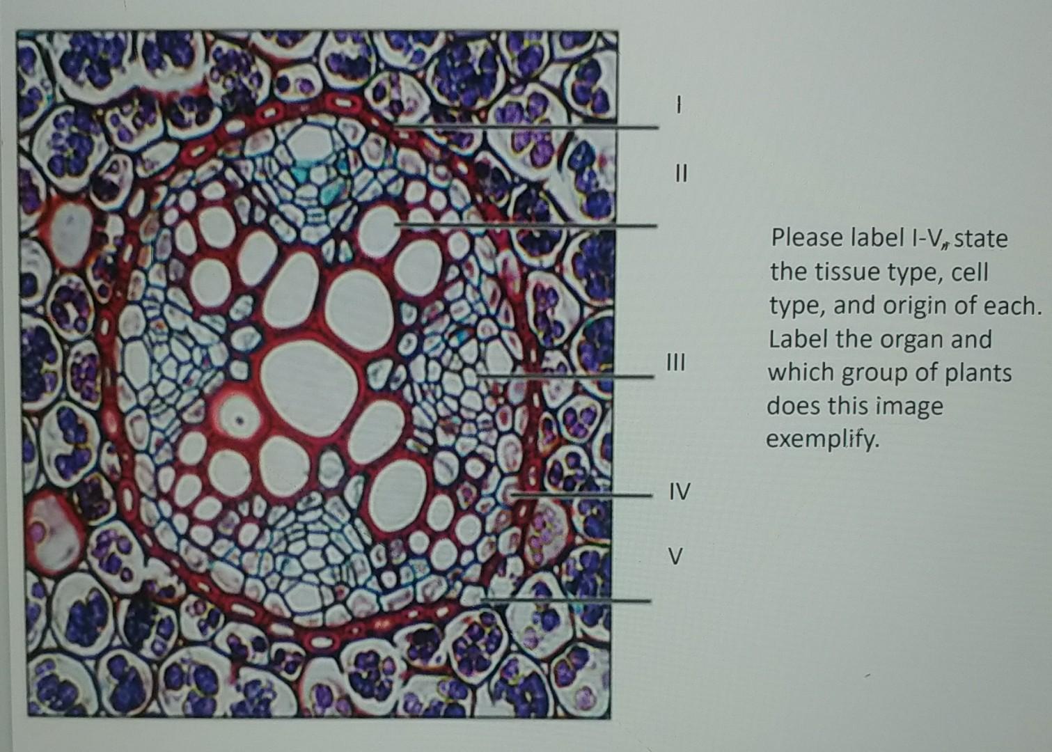 Solved Please label I- Vn ﻿state the tissue type, cell type, | Chegg.com