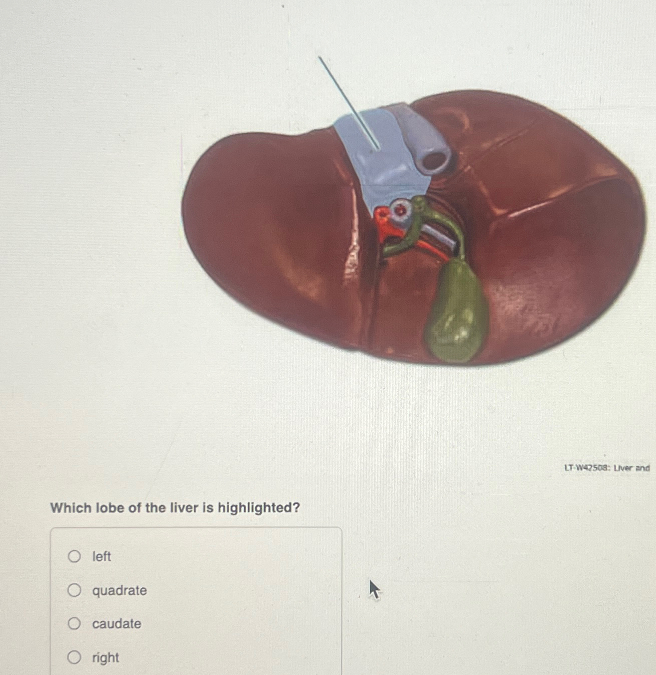 Solved LT-W42503: Liver andWhich lobe of the liver is | Chegg.com