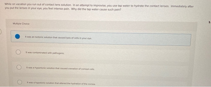 Solved Cell shrinking, also known as crenation, occurs when | Chegg.com