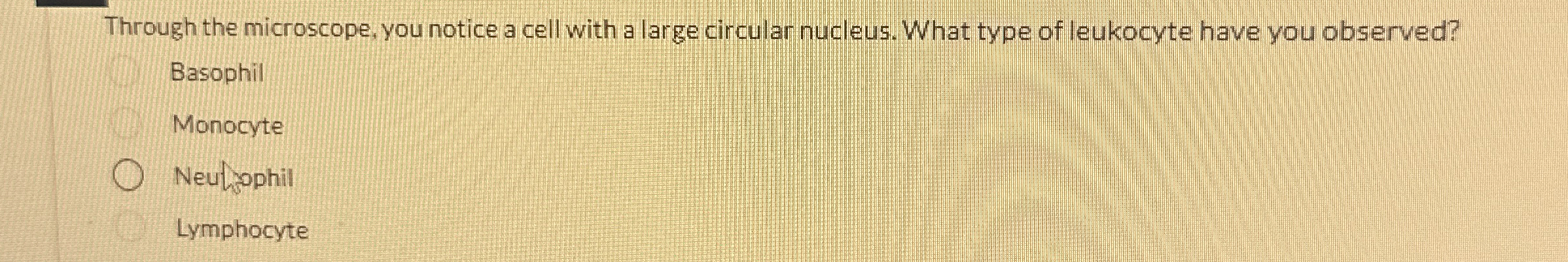 Solved Through the microscope, you notice a cell with a | Chegg.com
